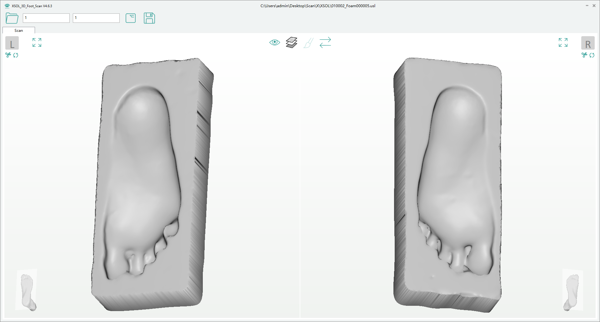维码科技 | Vismach 3D Laser Foot Scanner | Orthotic Insole CAD & CAM ...