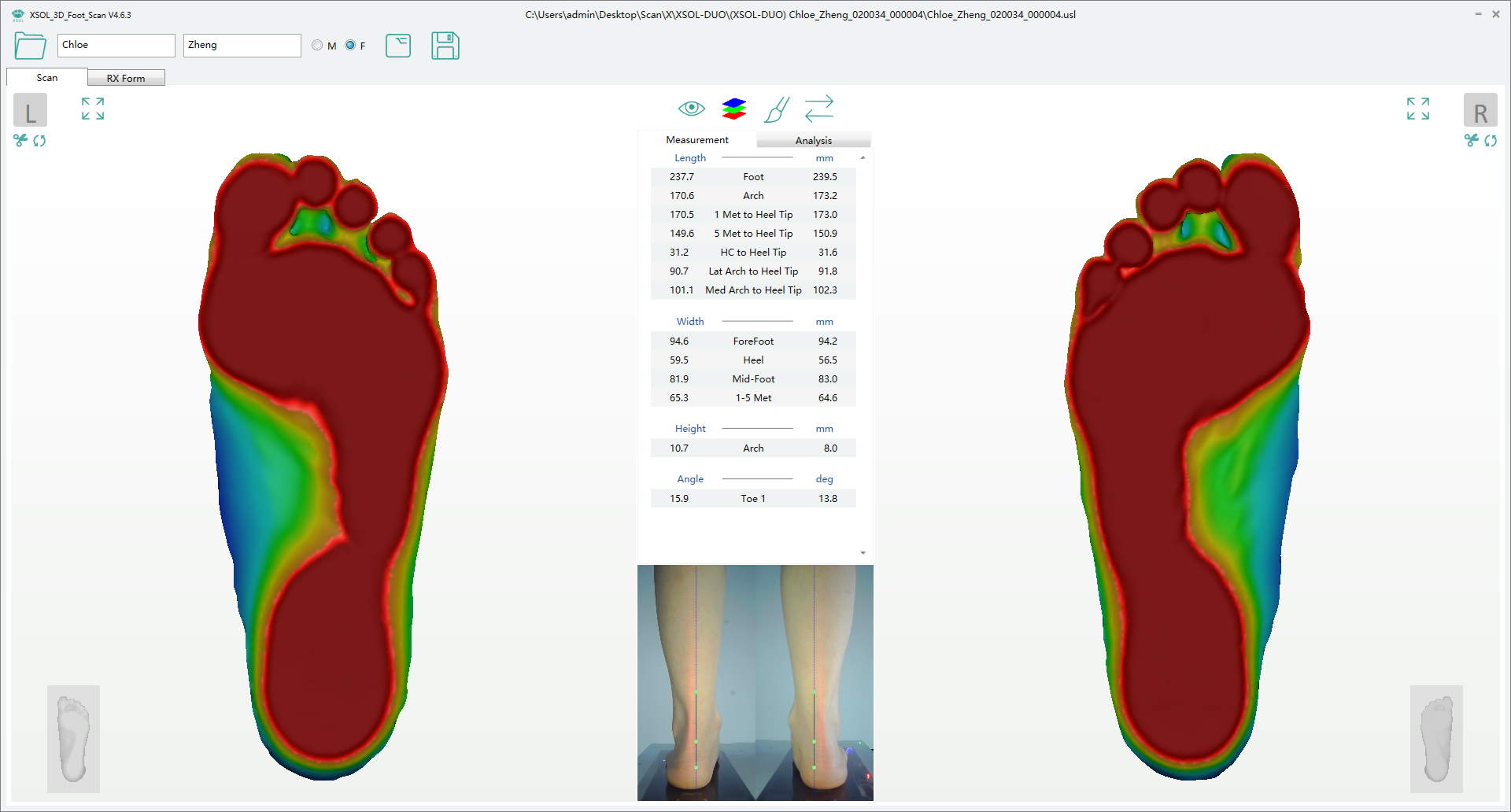 维码科技 | Vismach 3D Laser Foot Scanner | Orthotic Insole CAD & CAM ...
