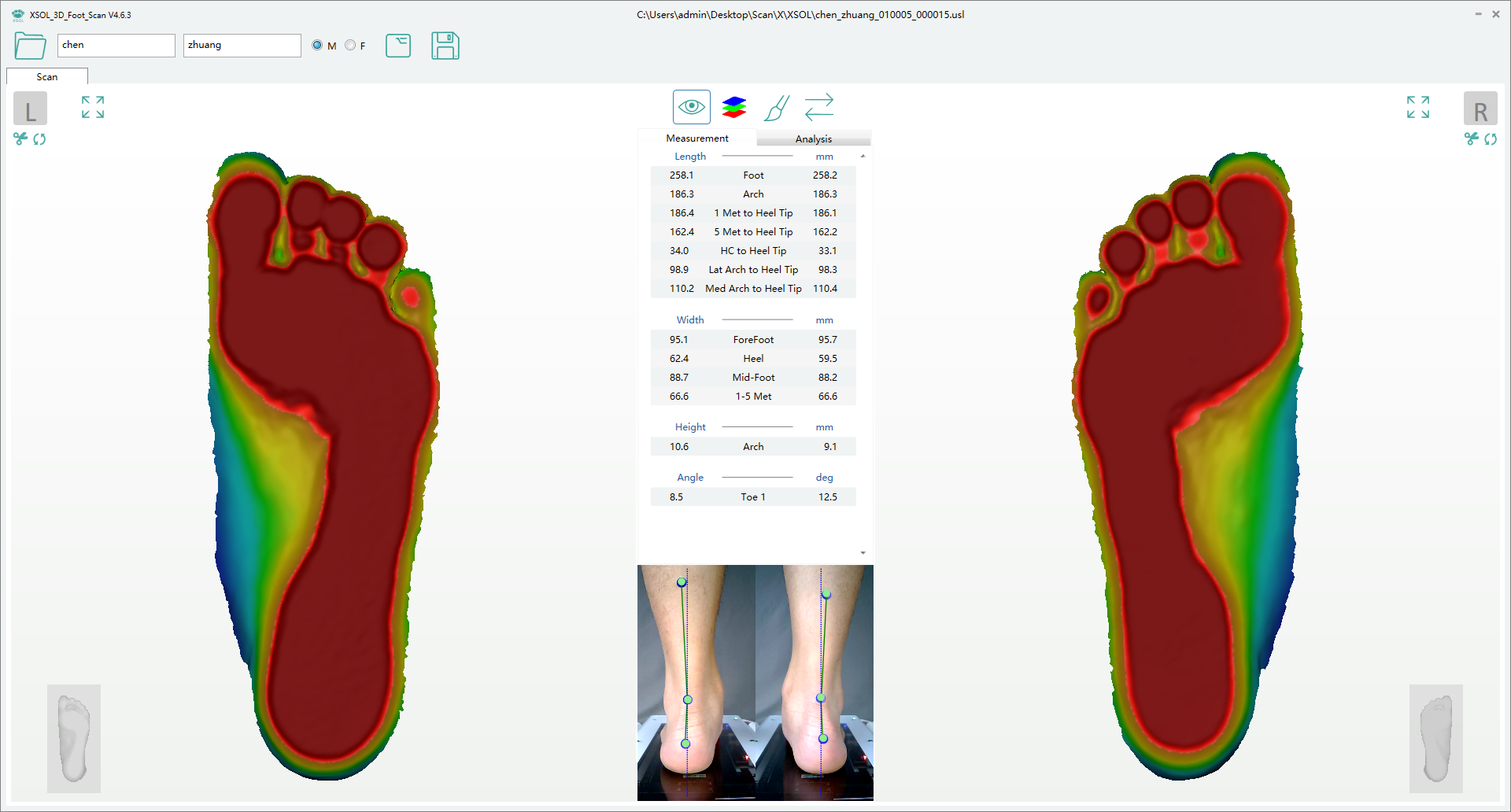 维码科技 | Vismach 3D Laser Foot Scanner | Orthotic Insole CAD & CAM ...